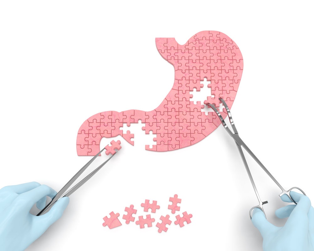 What Is Metabolic Surgery And How Did It Make Its Way Into The Ada