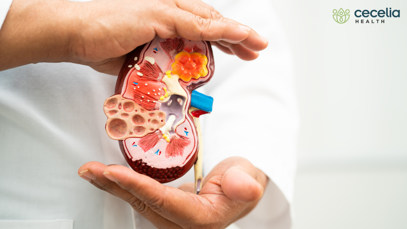 Basics of Chronic Kidney Disease - Cecelia Health